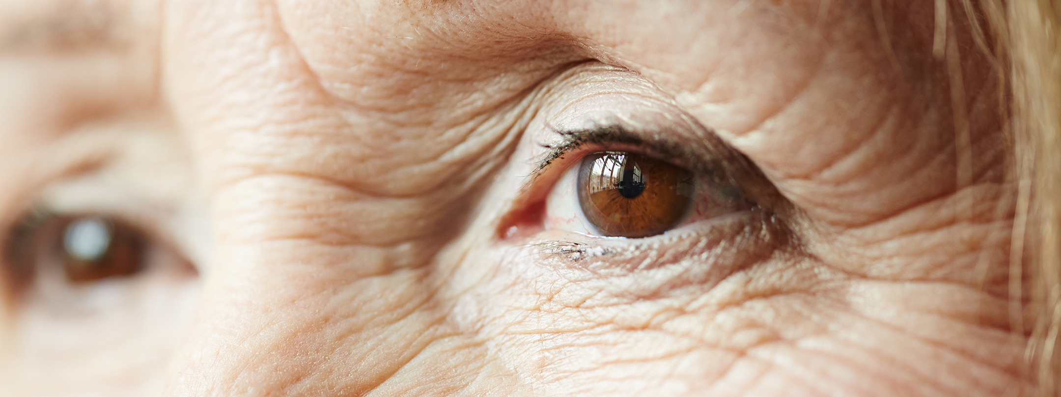 4 Age-Related Eye Diseases to Know | Select Health