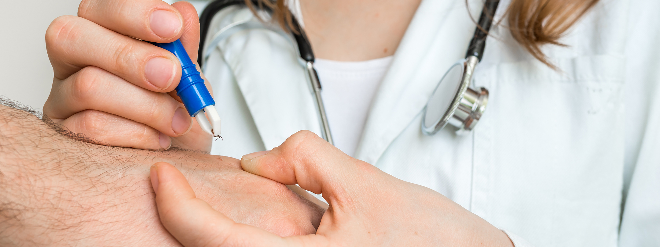 How to Protect Yourself Against Lyme Disease | Select Health